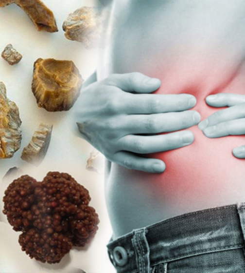 Varikosel Nedir? Tanı ve Tedavi Yöntemleri Nelerdir?